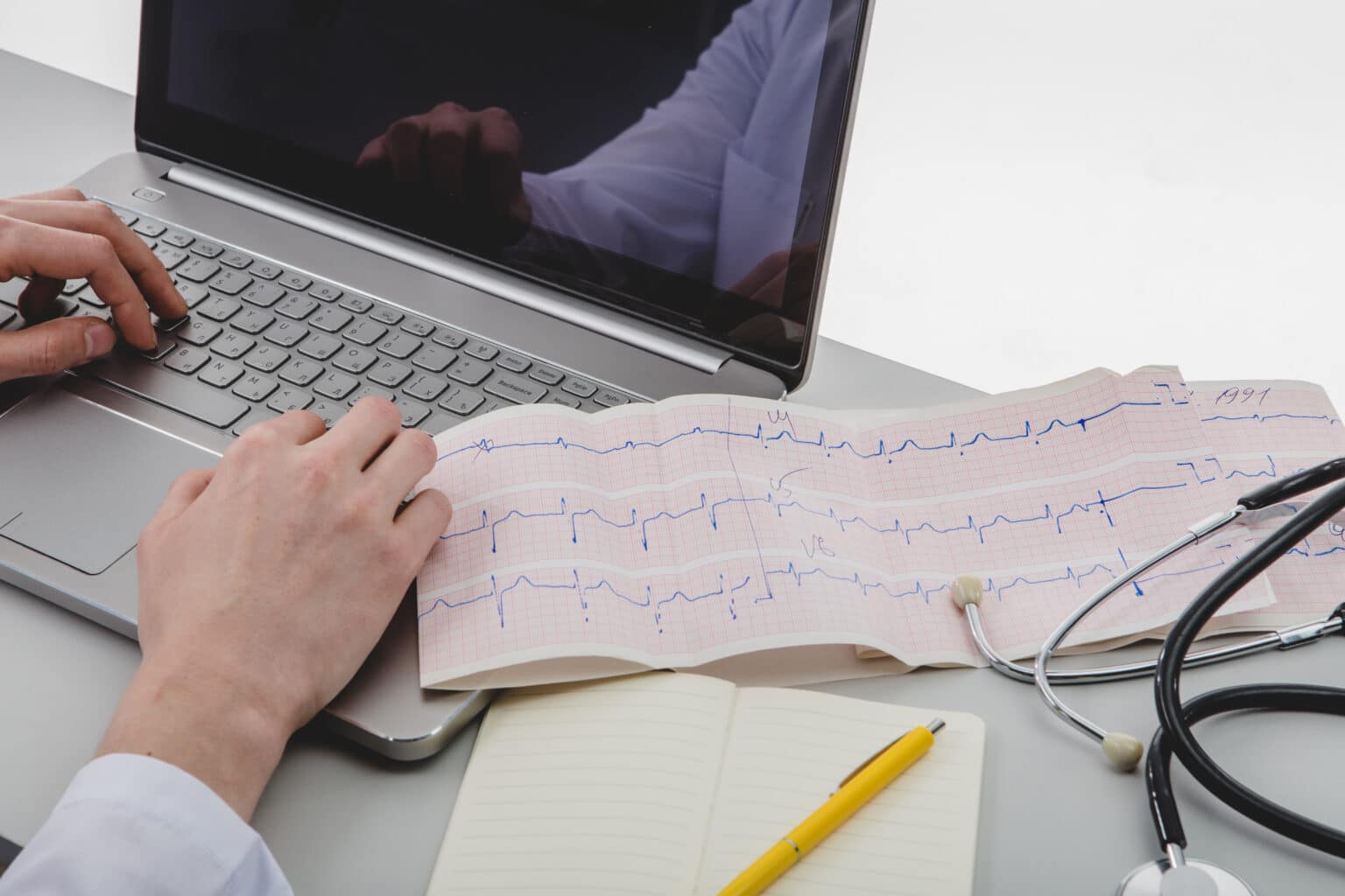 Comment lire un électrocardiogramme (ECG)